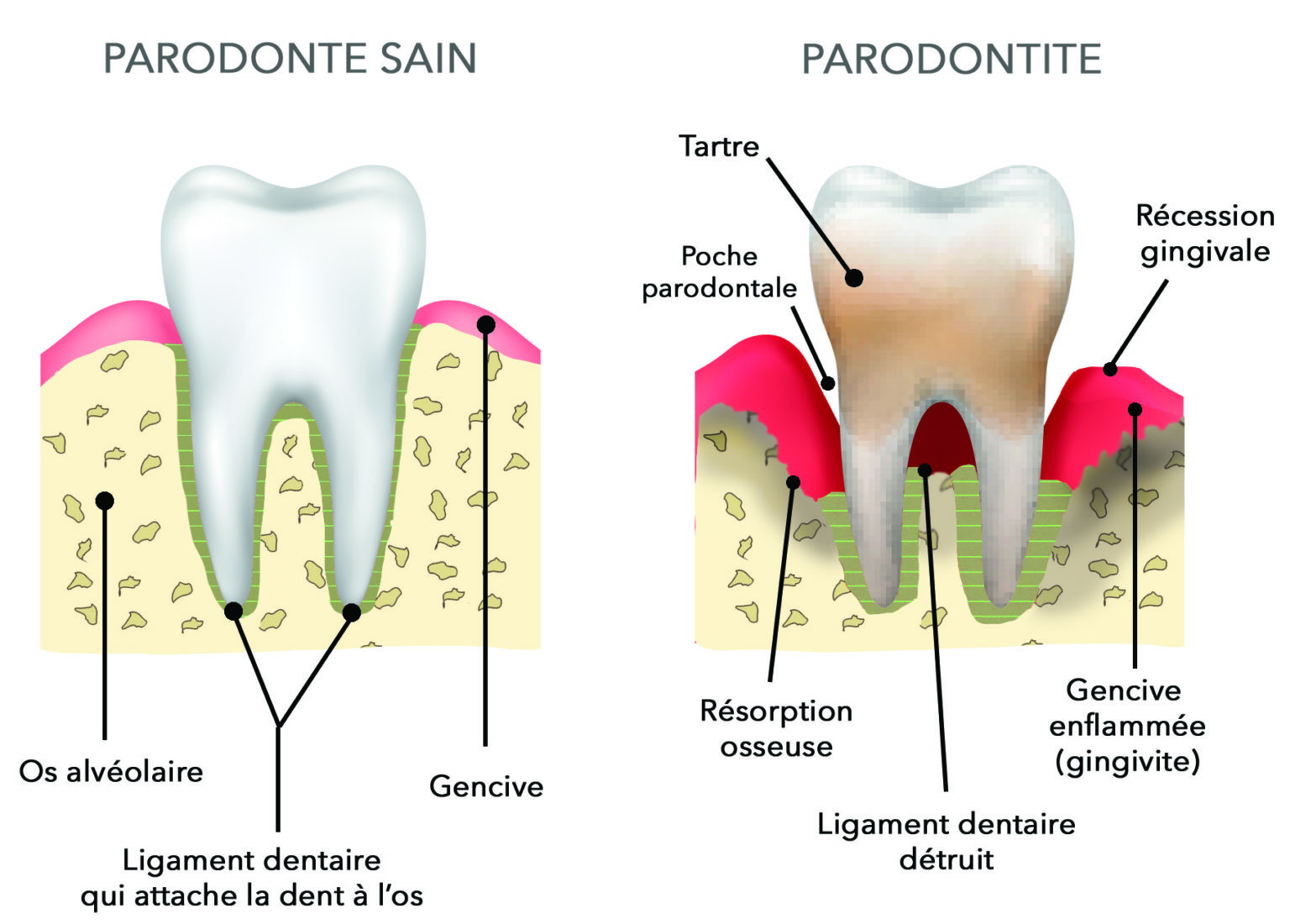 Traitements & greffes de gencives - Dr. François Maschino